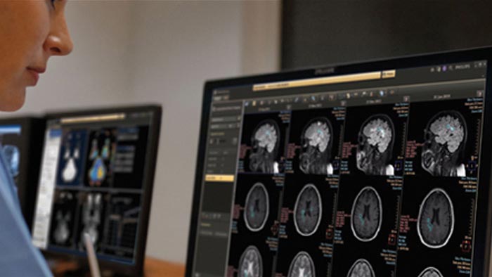 Philips showcases new connected innovations across the health continuum ...