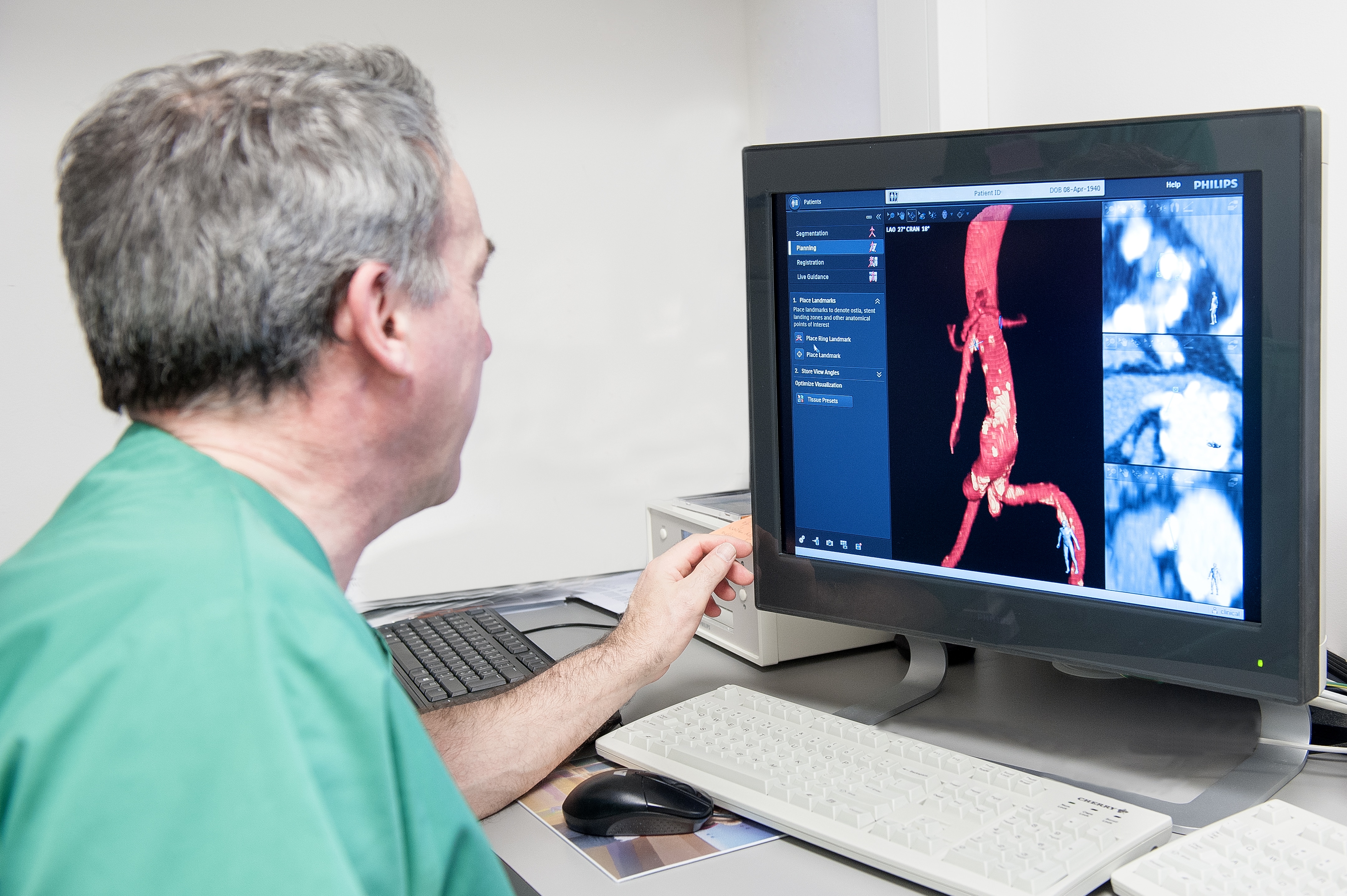 Philips en UZ Gent ontwikkelen innovatief 3D-navigatiesysteem voor ...